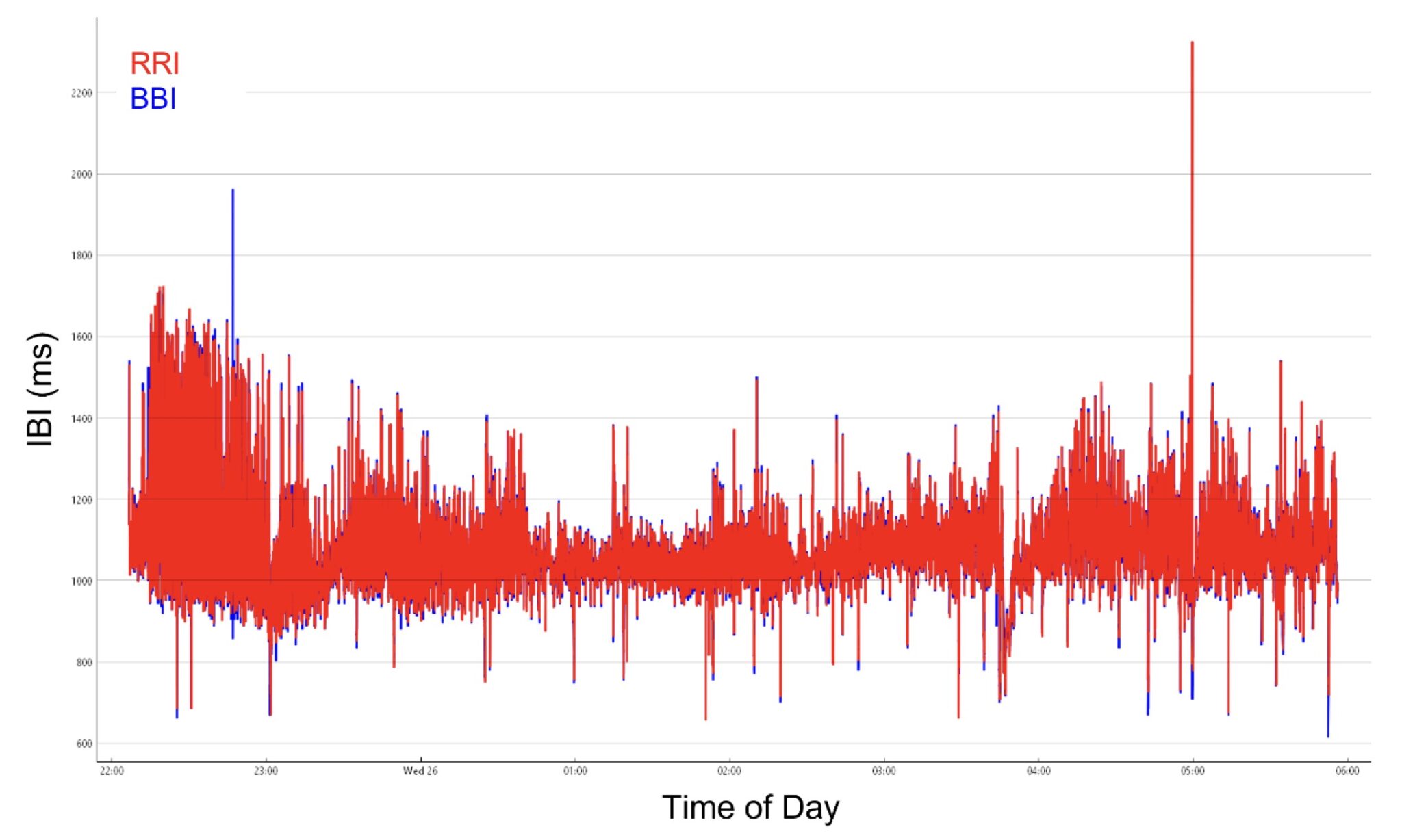 Enhanced BBI Measurement | Fitrockr
